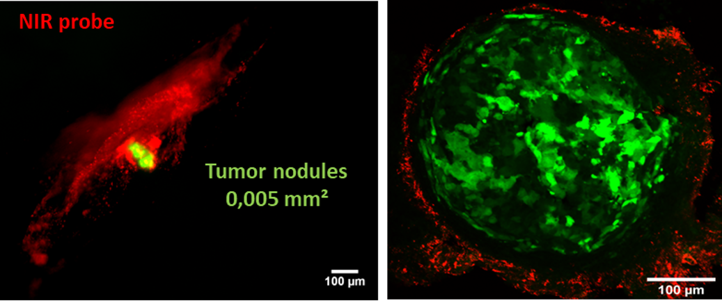 see2cure, the startup betting on fluorescence to guide abdominal cancer ...